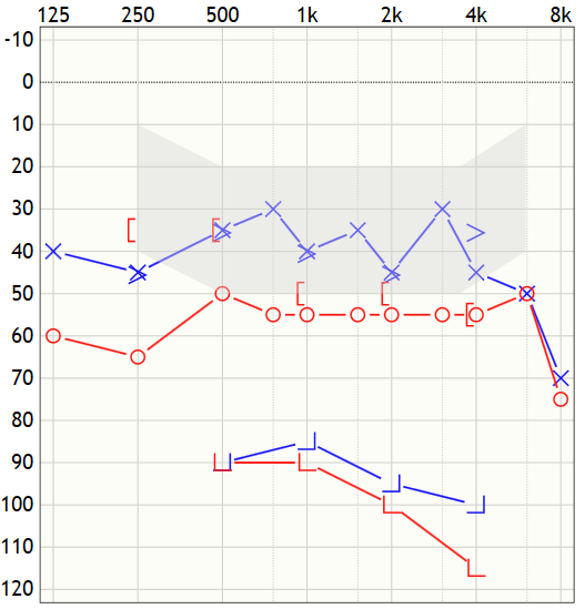 Badania słuchu - Audiometria Aparaty Słuchowe